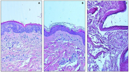 Antigenicity Preservation Is Related to Tissue Characteristics and the ...