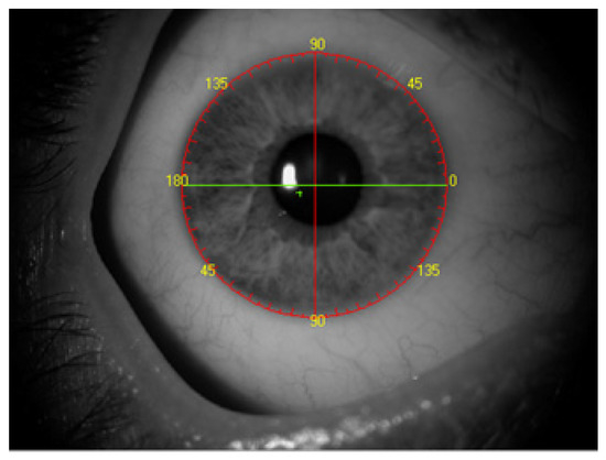 Comparison of INTEGRA and the Manual Method to Determine the Axis for ...