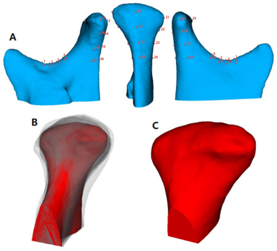 Healthcare | Free Full-Text | Assessment of Morphologic Change of ...