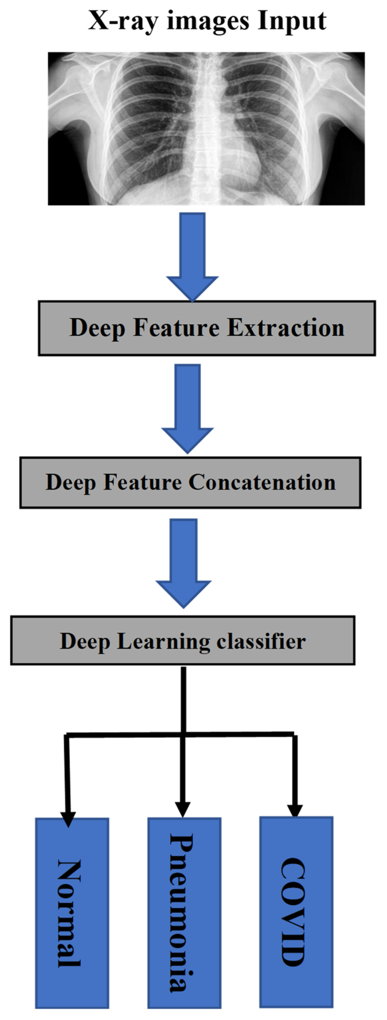 Healthcare | Free Full-Text | COVID-AleXception: A Deep Learning Model ...