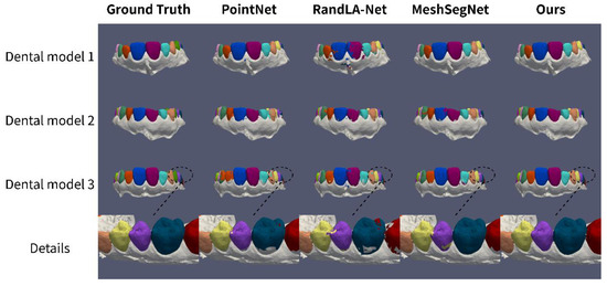 A Tooth Segmentation Method Based on Multiple Geometric Feature Learning