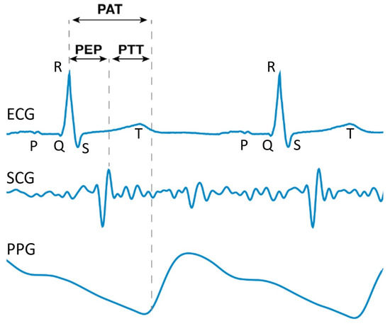 Healthcare | Free Full-Text | Blood Pressure Measurement: From Cuff ...