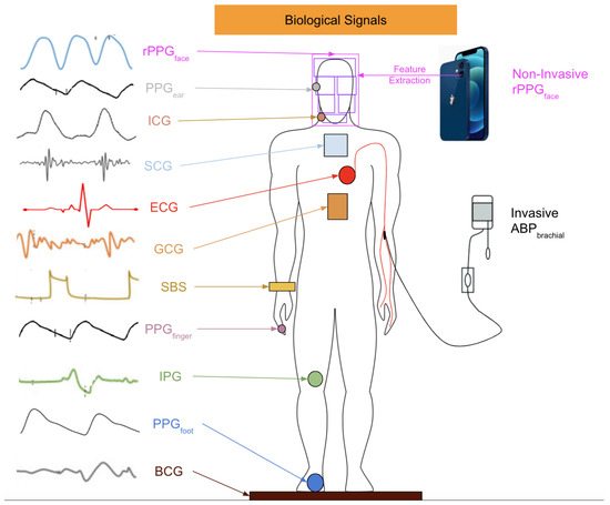 Blood Pressure Measurement: From Cuff-Based to Contactless Monitoring