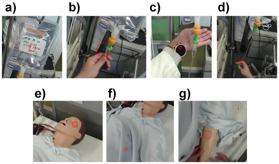 Eye-Tracking-Based Analysis of Situational Awareness of Nurses