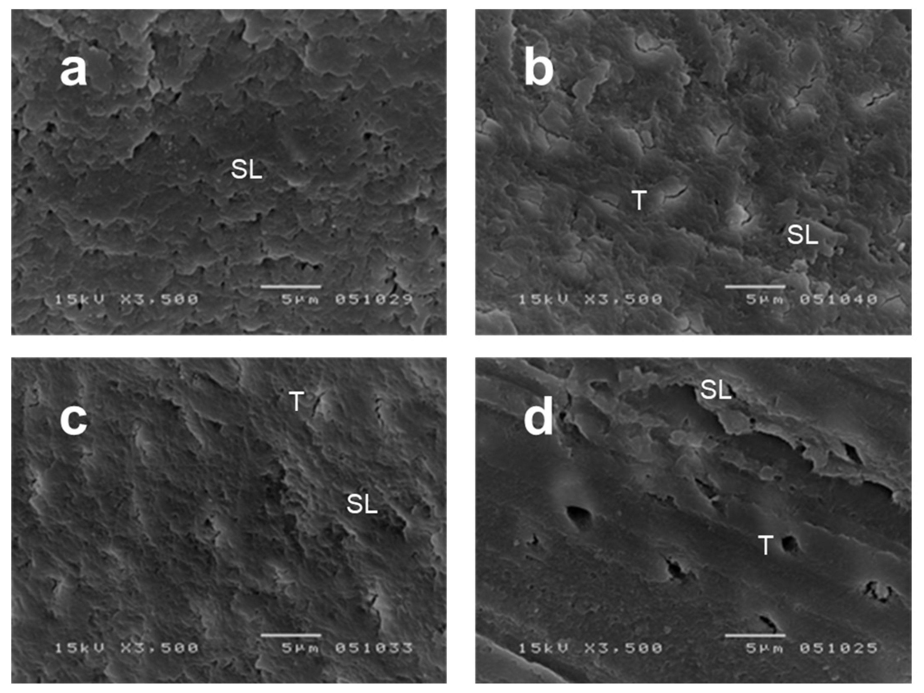 Effect of Method of Removing Caries-Affected Dentin on the Bond ...