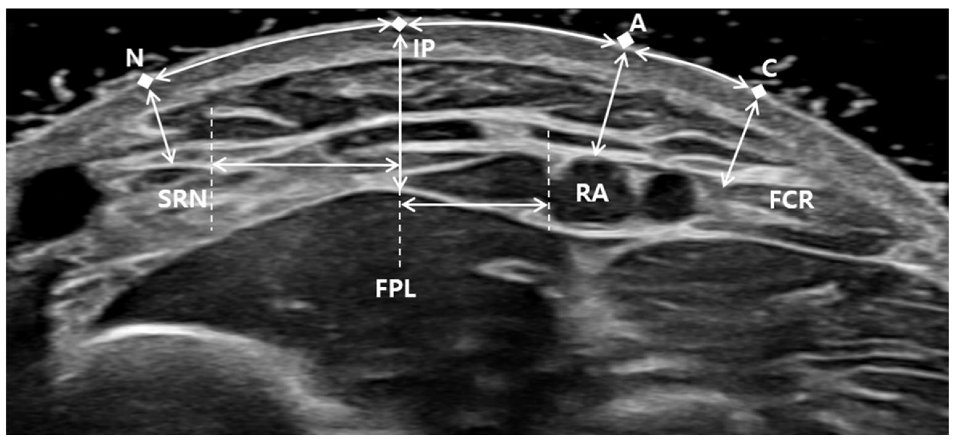 Healthcare | Free Full-Text | A Proposed Safe Electromyographic Needle ...