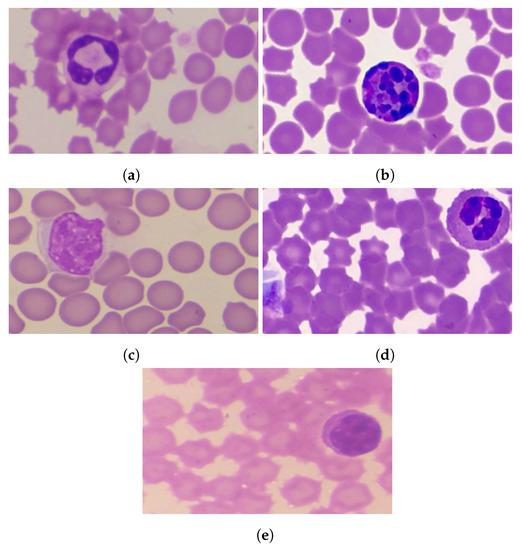 White Blood Cell Classification Using Texture and RGB Features of Oversampled Microscopic Images