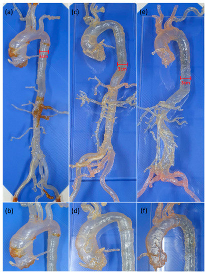 Patient-Specific 3D-Print Extracranial Vascular Simulators and Infrared ...