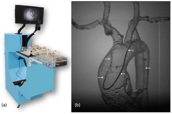 Patient-Specific 3D-Print Extracranial Vascular Simulators and Infrared ...