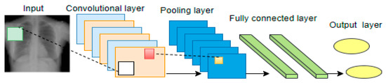 Ensemble Technique Coupled with Deep Transfer Learning Framework for ...
