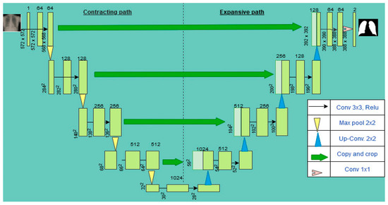 Ensemble Technique Coupled with Deep Transfer Learning Framework for ...