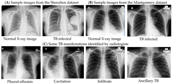 Ensemble Technique Coupled with Deep Transfer Learning Framework for ...