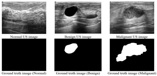 Breast Cancer Classification by Using Multi-Headed Convolutional Neural ...