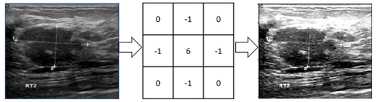 Breast Cancer Classification by Using Multi-Headed Convolutional Neural ...
