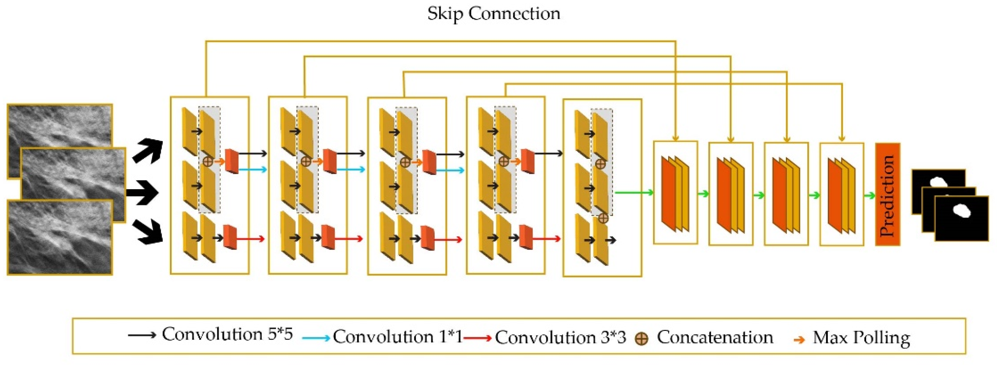 Breast Cancer Dataset, Classification and Detection Using Deep Learning