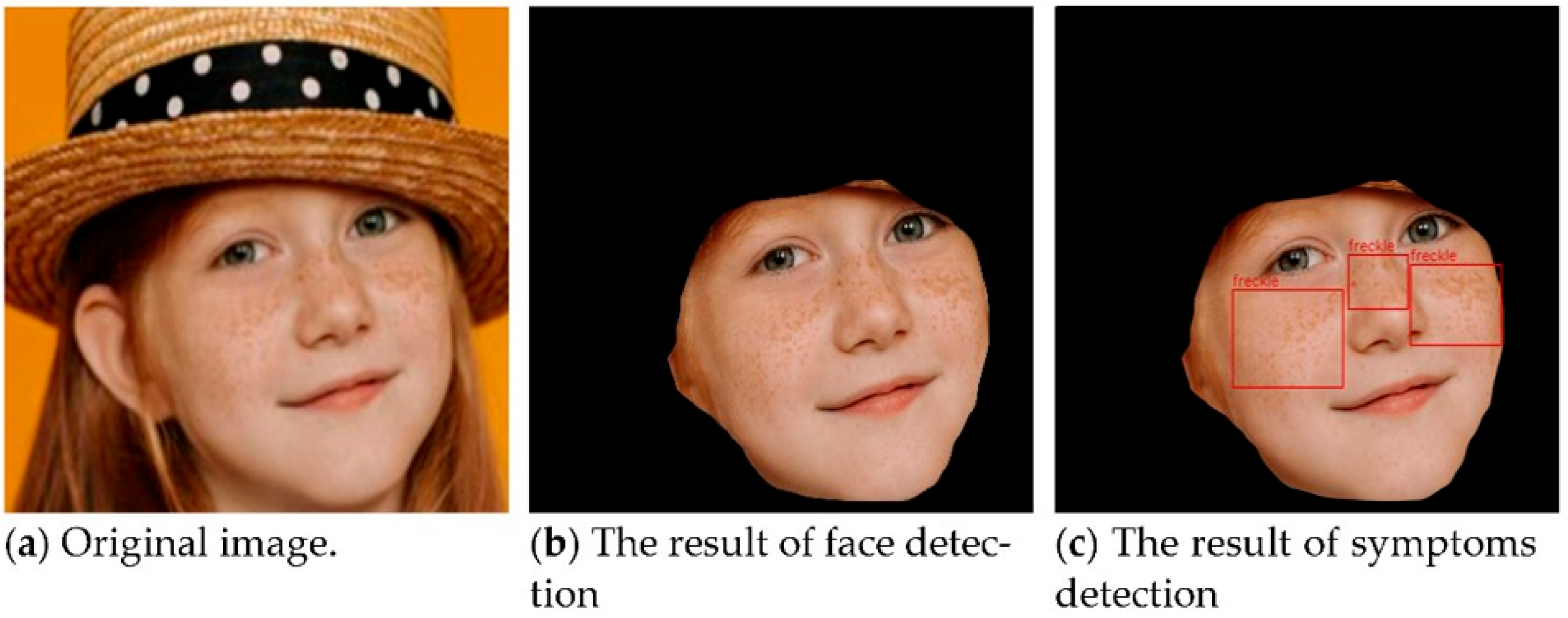 An Optimization-Based Technology Applied for Face Skin Symptom Detection