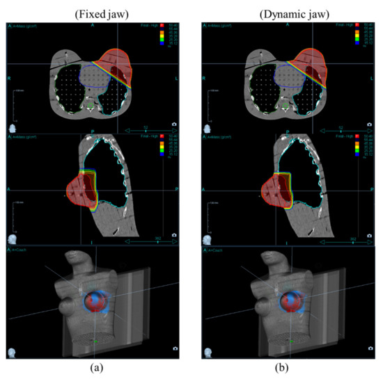 Healthcare | Free Full-Text | Comparison of Jaw Mode and Field Width ...