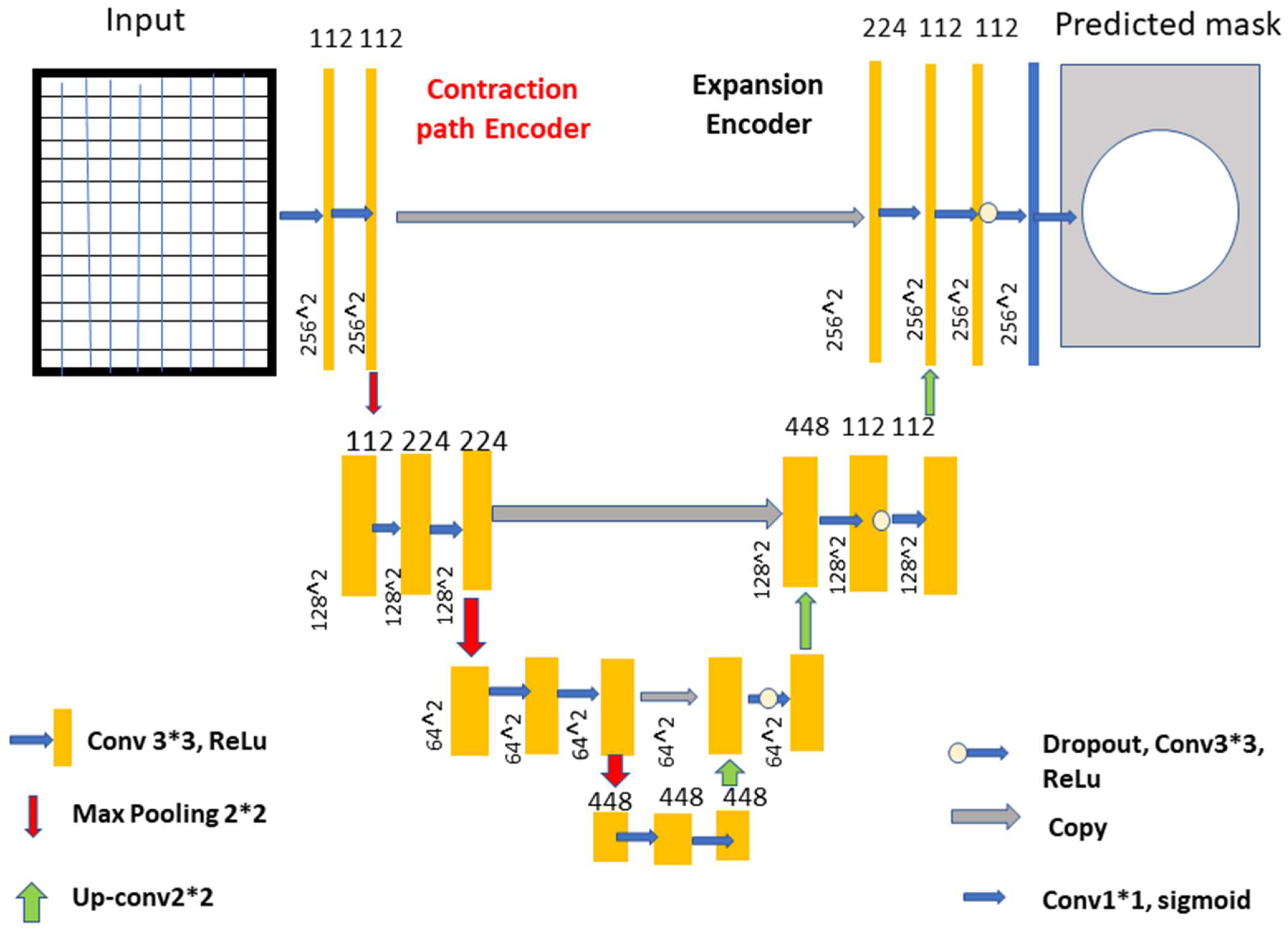 Glaucoma Detection And Classification Using Improved U Net Deep Learning Model