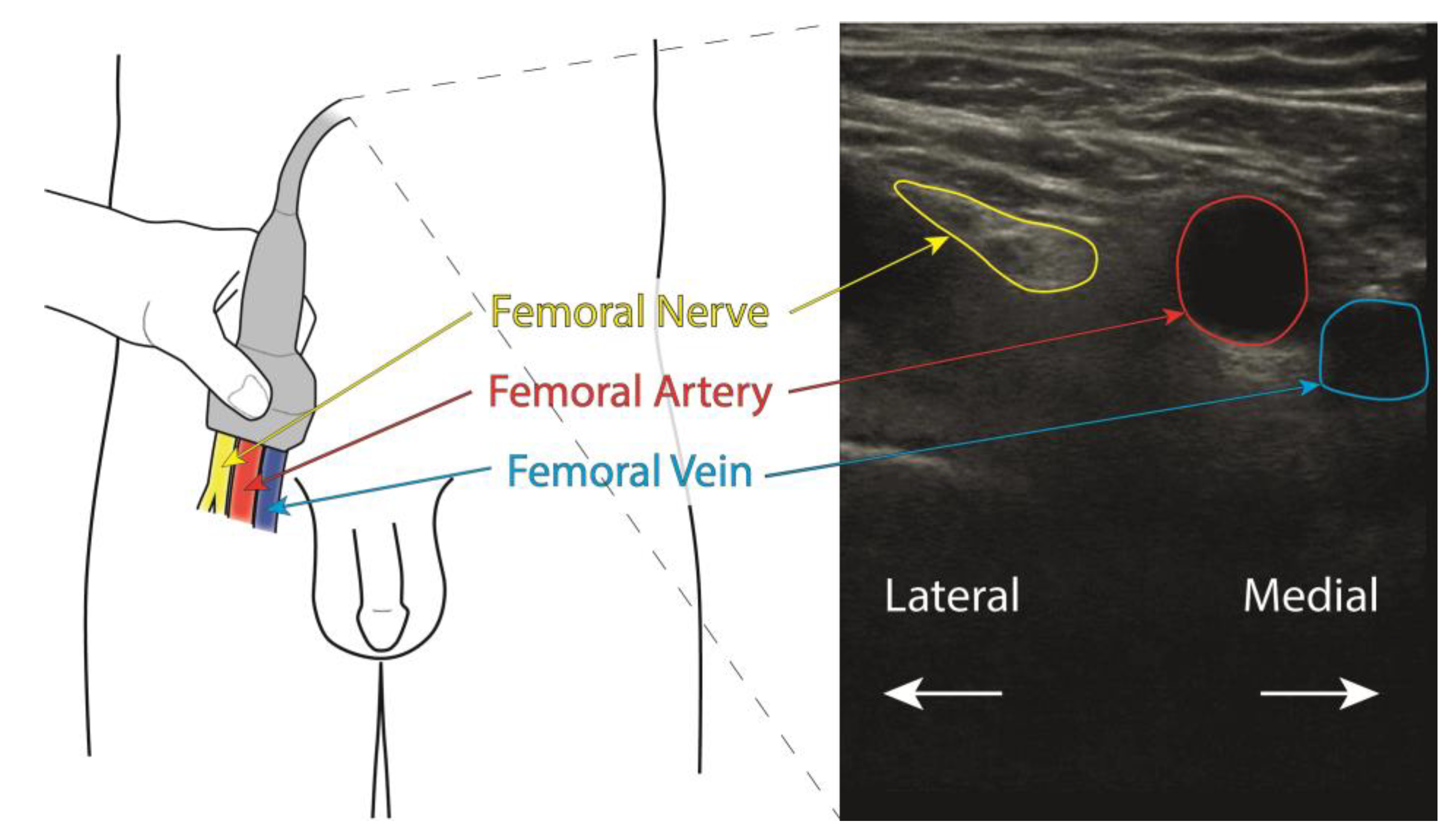 Healthcare Free Full Text Deep Learning On Ultrasound Images