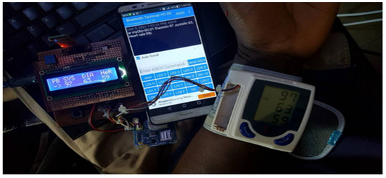 Developing a Low-Cost IoT-Based Remote Cardiovascular Patient ...
