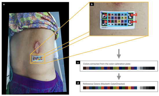 Healthcare | Free Full-Text | AI-Assisted Assessment of Wound Tissue ...