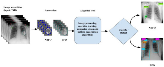 Analyzing Overlaid Foreign Objects in Chest X-rays—Clinical Significance and Artificial ...