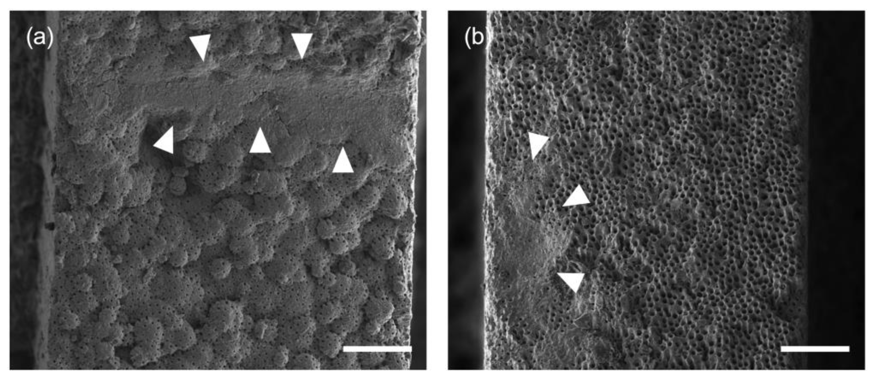 Impact of Endodontic Irrigant Activation on Smear Layer Removal and ...