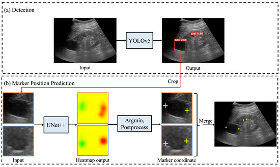 Automatic Detection and Measurement of Renal Cysts in Ultrasound Images: A Deep Learning Approach