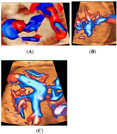 Application of Color Doppler with 3- and 4-Dimensional Ultrasonography ...
