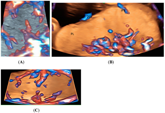 Application of Color Doppler with 3- and 4-Dimensional Ultrasonography ...