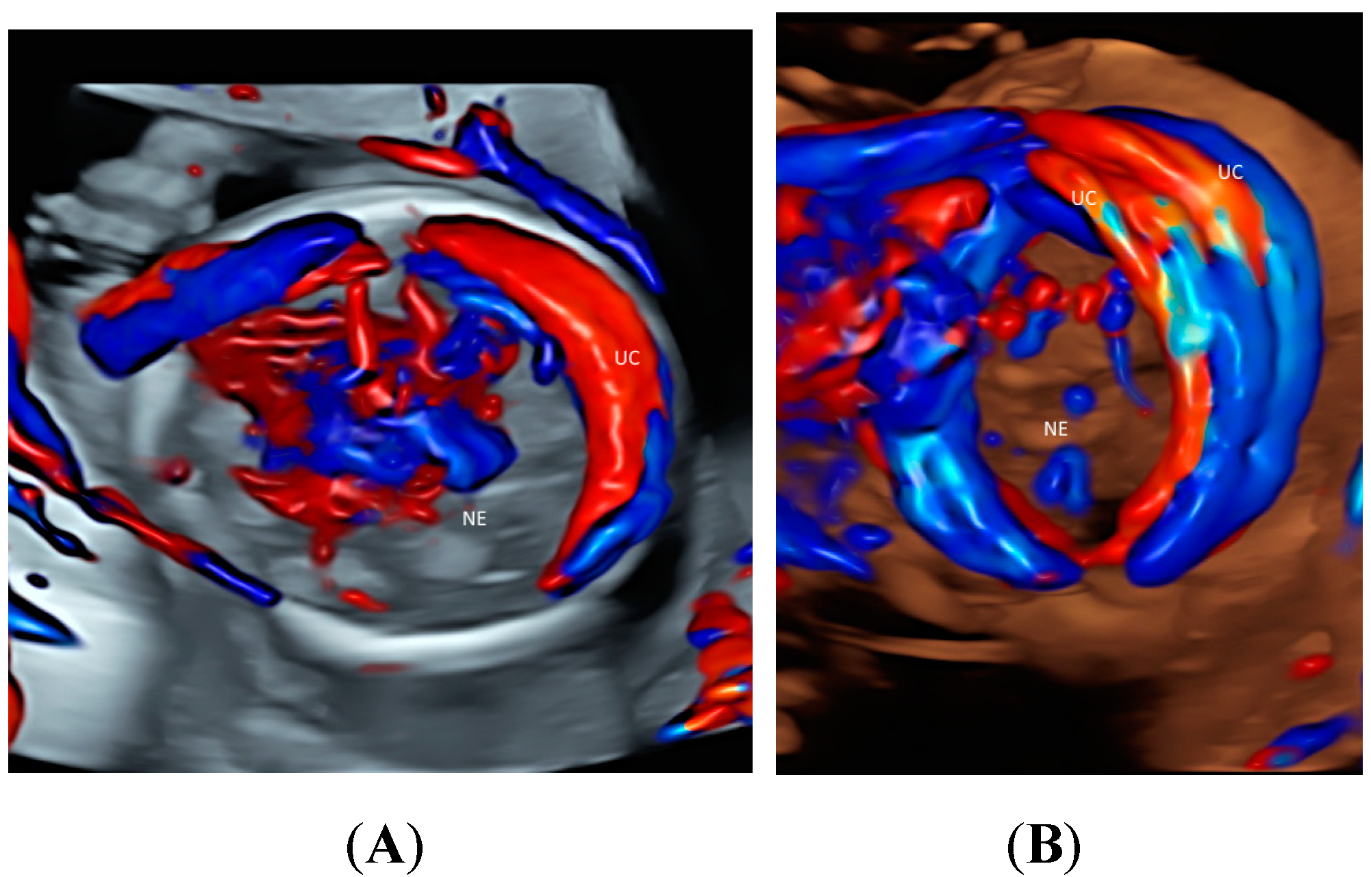 Application of Color Doppler with 3- and 4-Dimensional Ultrasonography ...