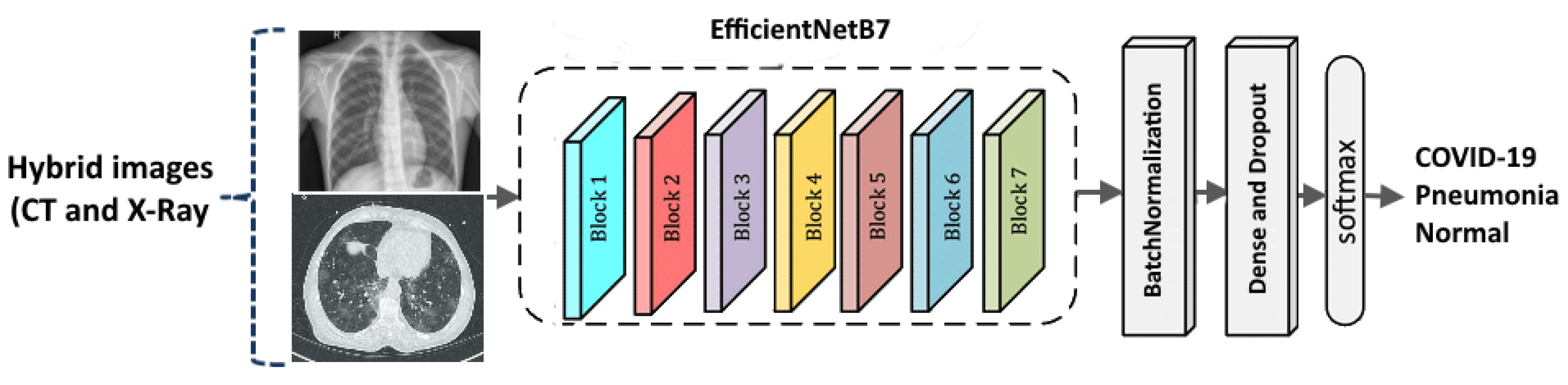 On the Implementation of a Post-Pandemic Deep Learning Algorithm Based on a Hybrid CT-Scan/X-ray ...