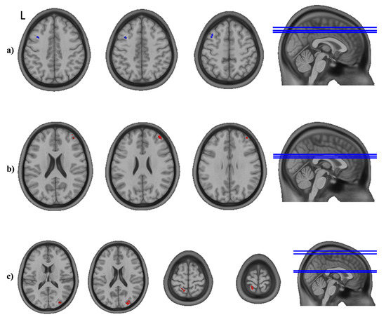 Healthcare Free Full Text Physical Activity Alters Functional
