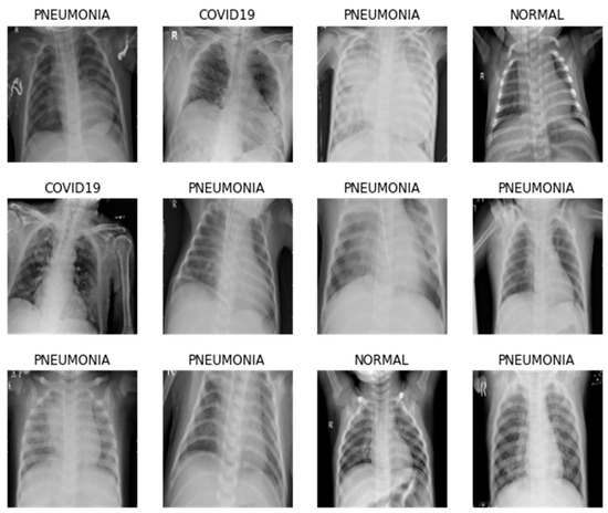 Healthcare | Free Full-Text | Computer-Aided Diagnosis of COVID-19 from Chest X-ray Images Using ...