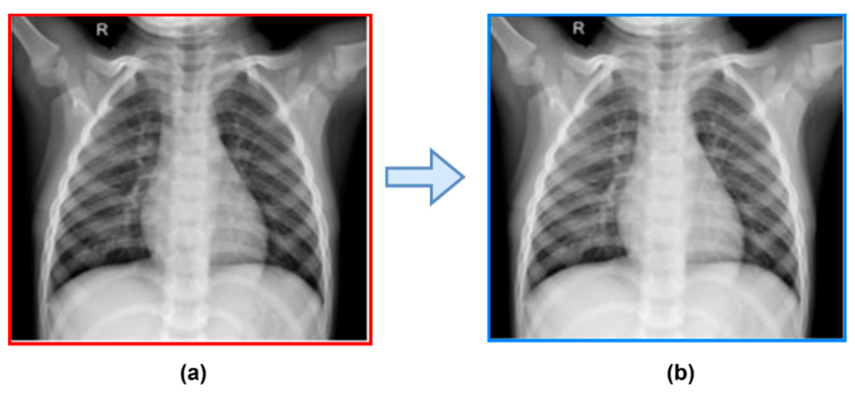 Healthcare | Free Full-Text | Computer-Aided Diagnosis of COVID-19 from Chest X-ray Images Using ...