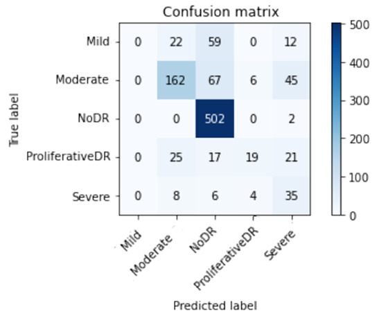 Deep Learning-Based Prediction of Diabetic Retinopathy Using CLAHE and ...