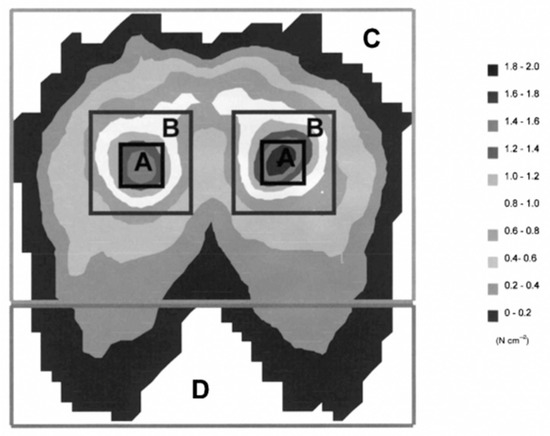 Hole Matrix Mapping Model for Partitioned Sitting Surface Based on ...