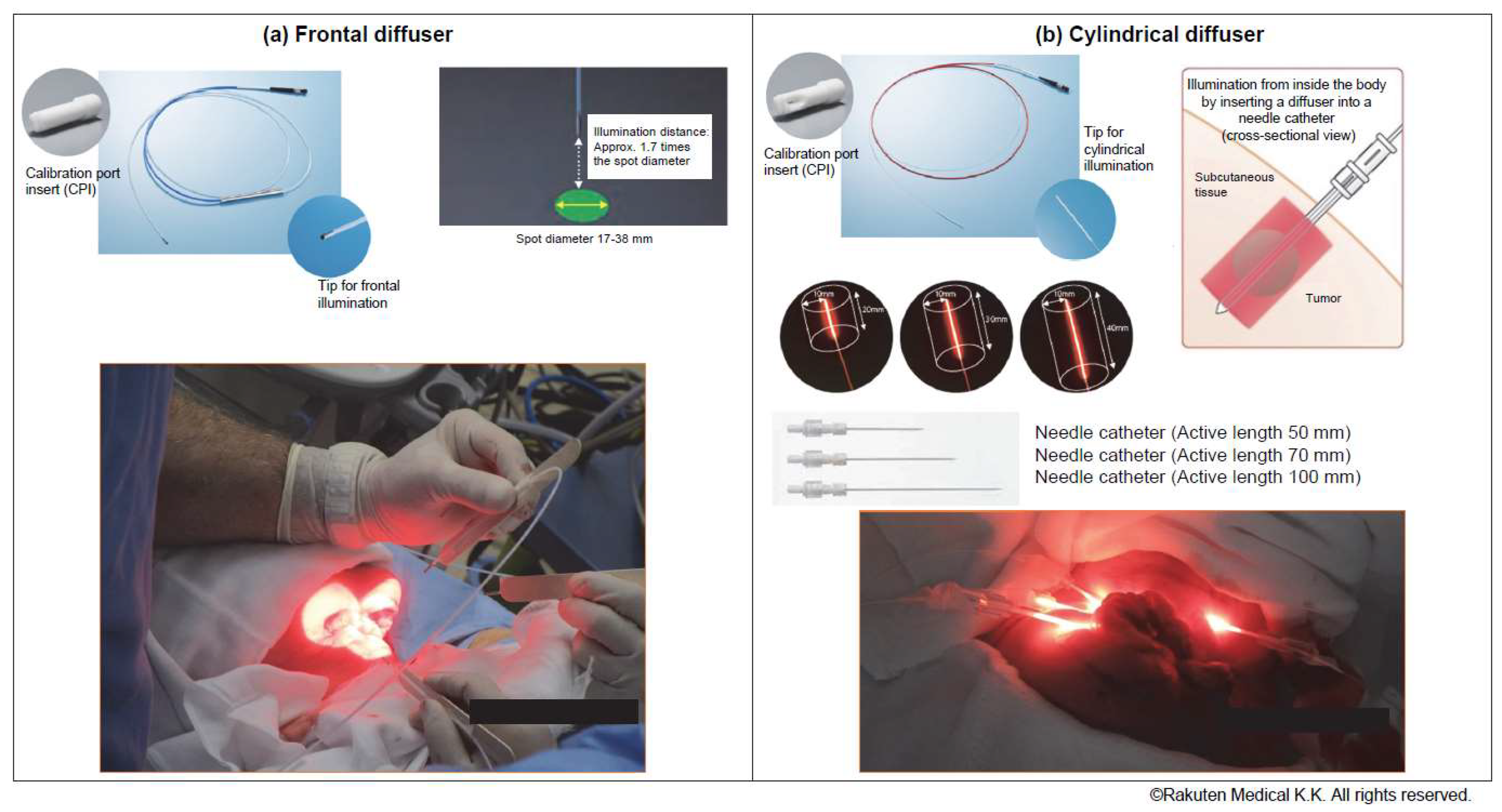 A Case Series on Pain Accompanying Photoimmunotherapy for Head and Neck ...