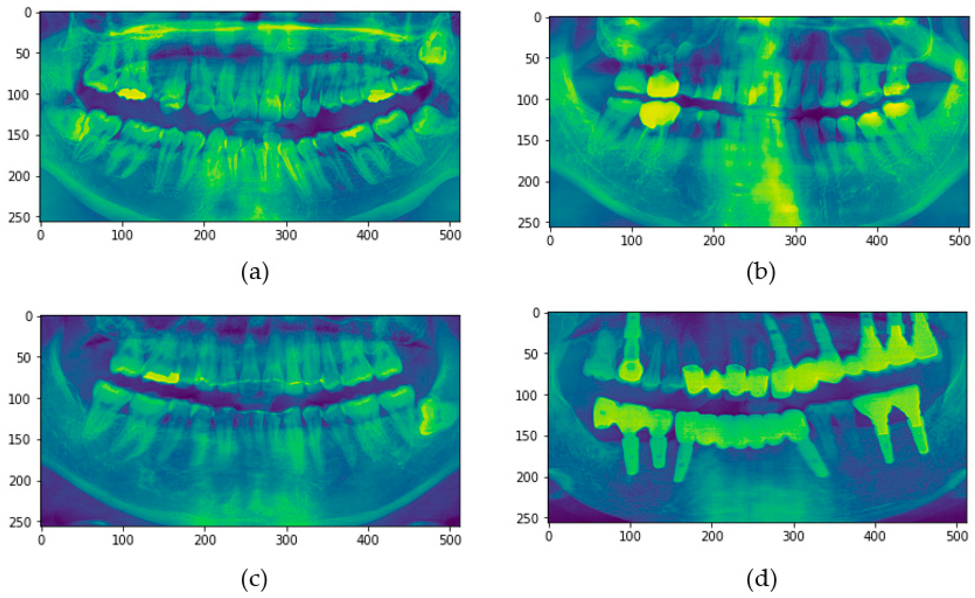 Age Group Classification of Dental Radiography without Precise Age Information Using ...