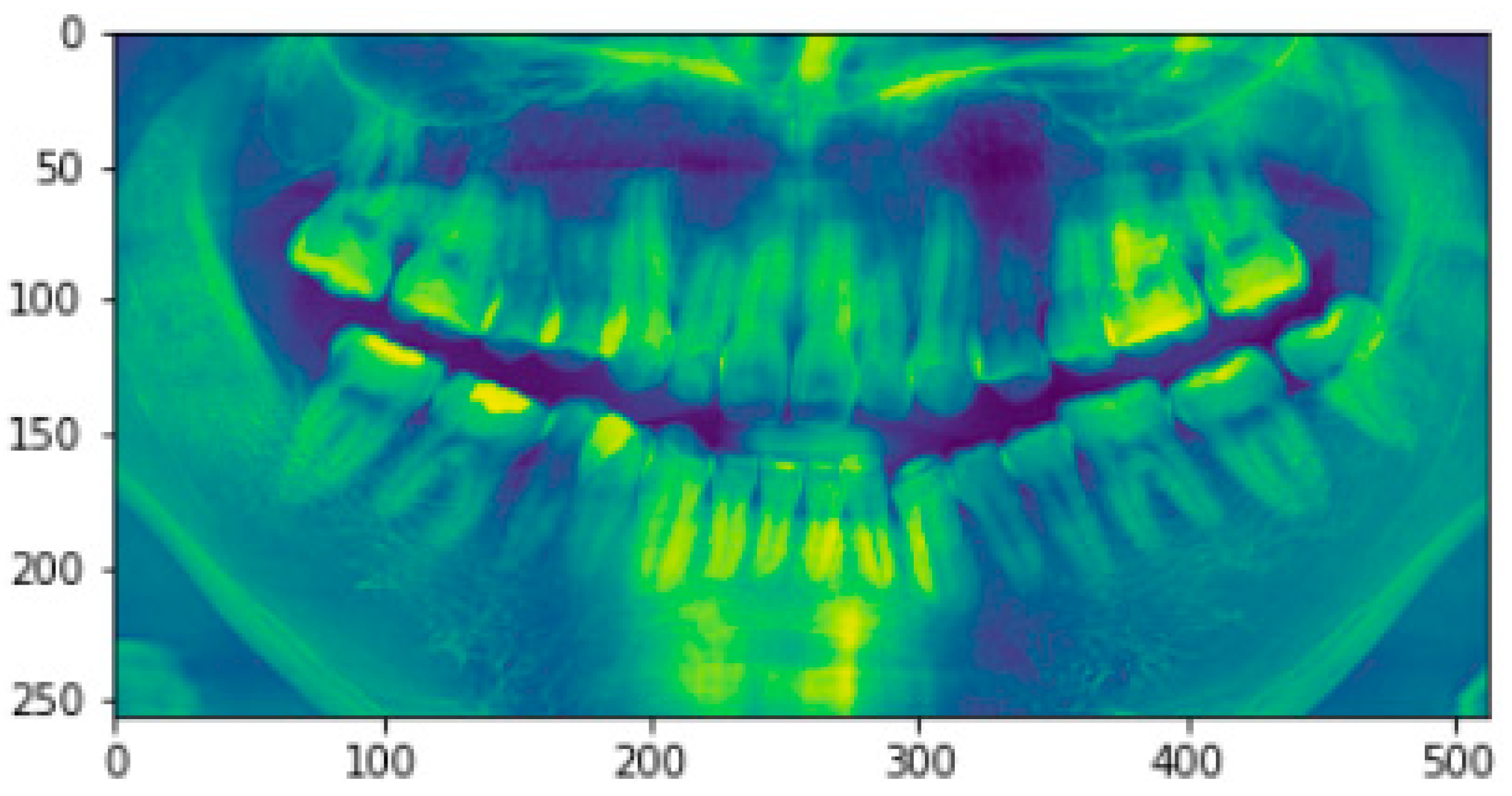 Age Group Classification of Dental Radiography without Precise Age Information Using ...