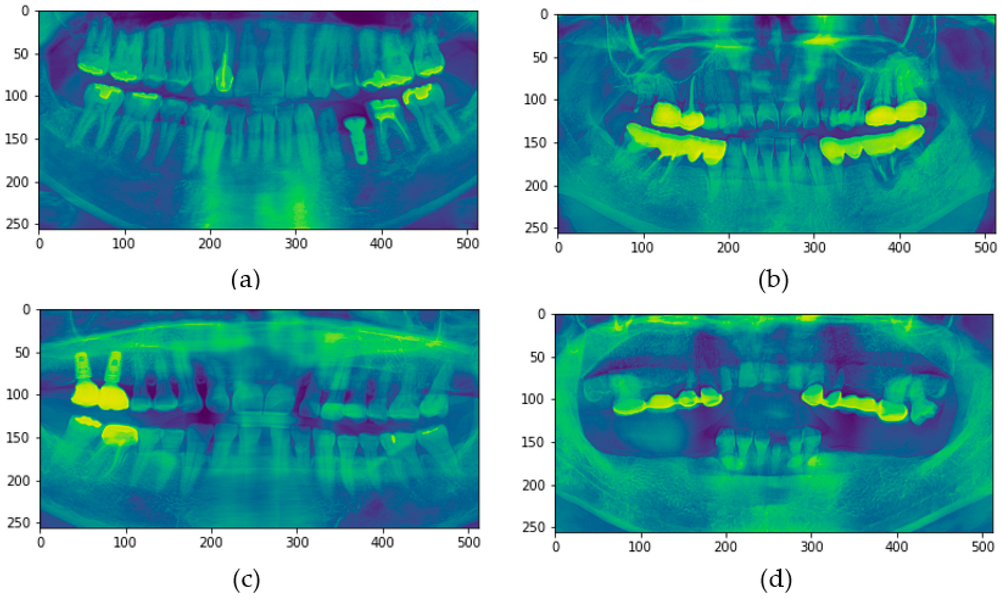 Age Group Classification of Dental Radiography without Precise Age ...