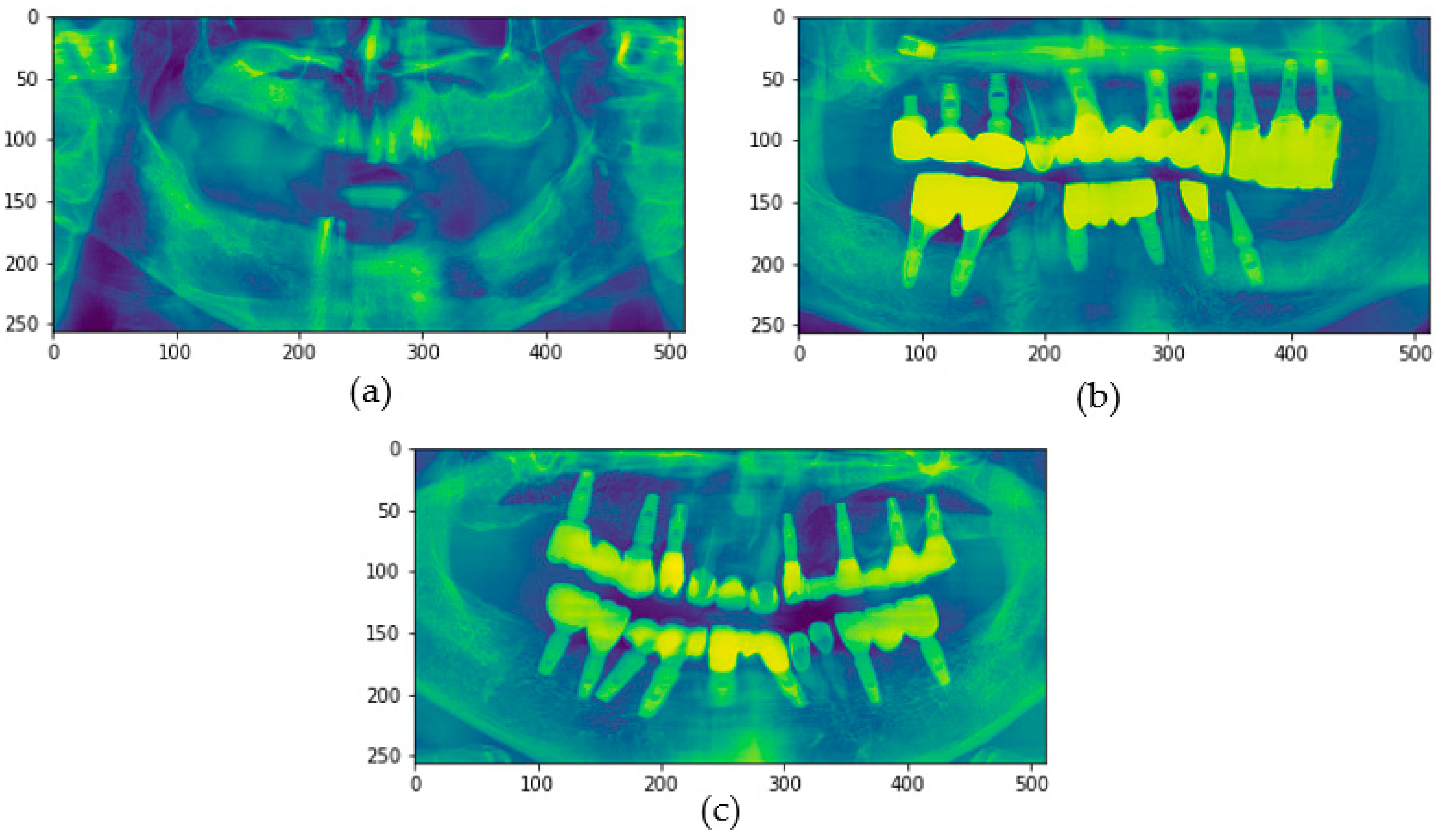Age Group Classification of Dental Radiography without Precise Age Information Using ...