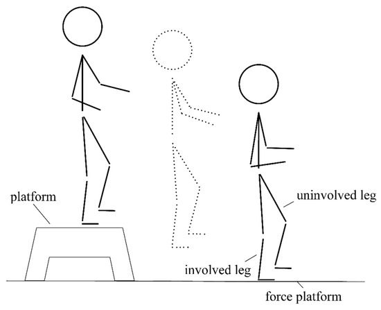 Effects of Attrition Shoes on Balance Control Ability and Postural ...