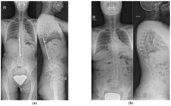 Healthcare | Free Full-Text | No Significant Radiological Signs of ...