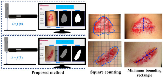 Convolution Neural Network with Coordinate Attention for Real-Time Wound Segmentation and ...