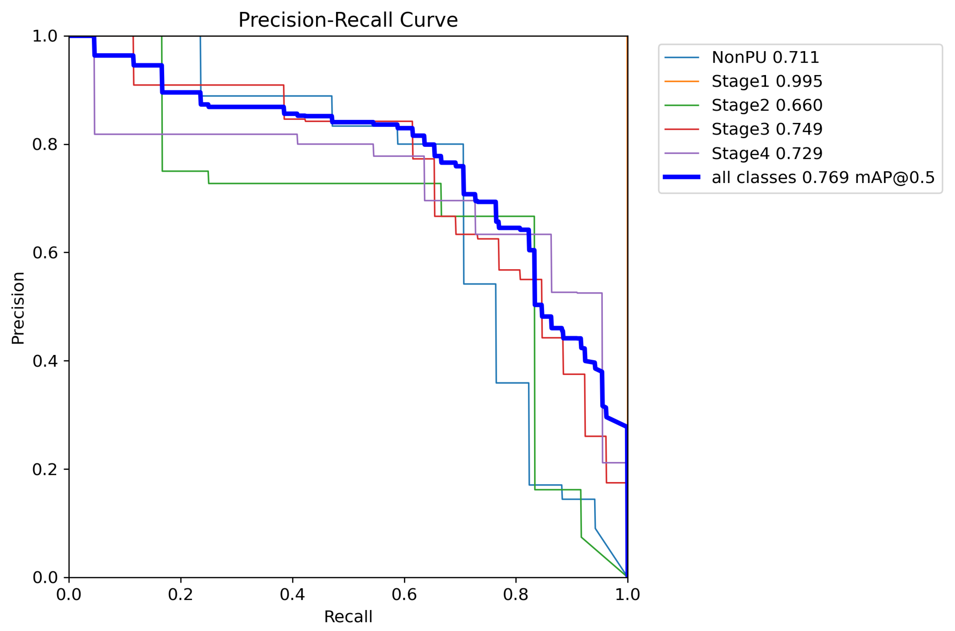 YOLO-Based Deep Learning Model for Pressure Ulcer Detection and Classification
