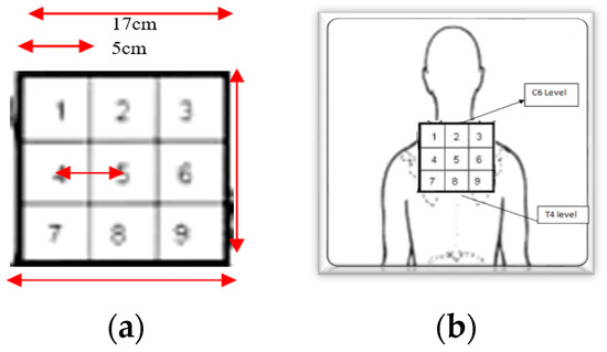 Manual Therapy versus Localisation (Tactile, Sensory Training) in ...