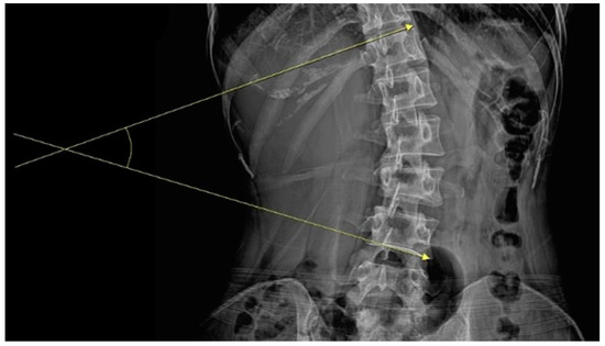 Effectiveness of Integrative Korean Medicine Treatment in Patients with ...