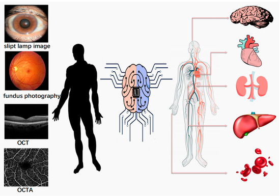 Healthcare | Free Full-Text | Diagnosing Systemic Disorders with AI Algorithms Based on Ocular ...