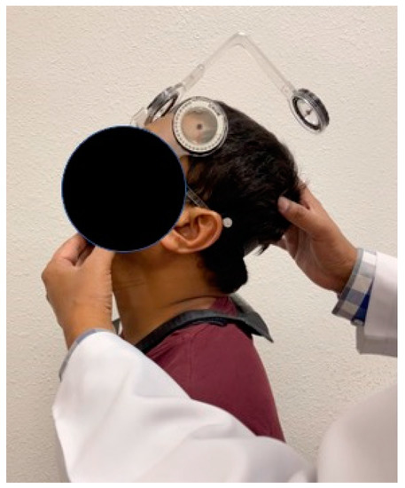 Age-Related Decline in Cervical Proprioception and Its Correlation with ...